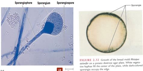 Lab Module Five Examination Of Eukaryotic Microbes Fungi Flashcards Quizlet Lab Module Five Examination Of Eukaryotic Microbes Fungi Flashcards Quizlet