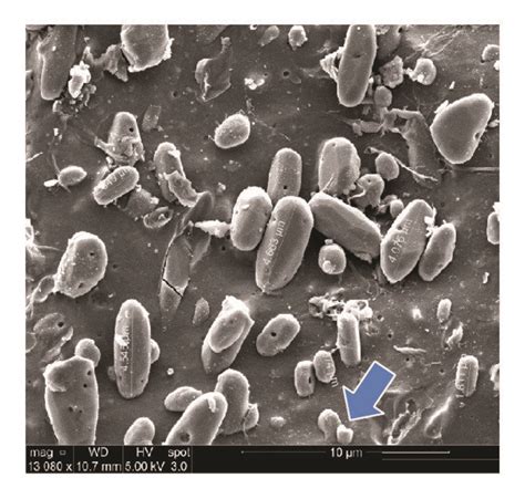 Variation In The Morphology Of Eutectic Si Particles In A413 Alloy As A
