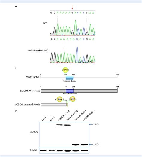 Figure 1 From A Homozygous Nobox Truncating Variant Causes Defective