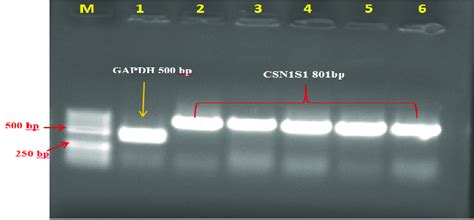 Gel Electrophoresis Of Bu Csn1s1 Gene Pcr Product Using Gene Specific Download Scientific