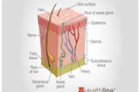 Necrotizing Fasciitis