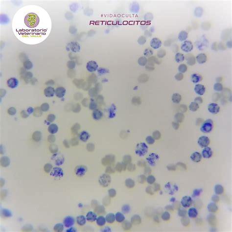 Laboratorio Veterinario Del Valle Vidaoculta Los Reticulocitos Son Eritrocitos Jóvenes O