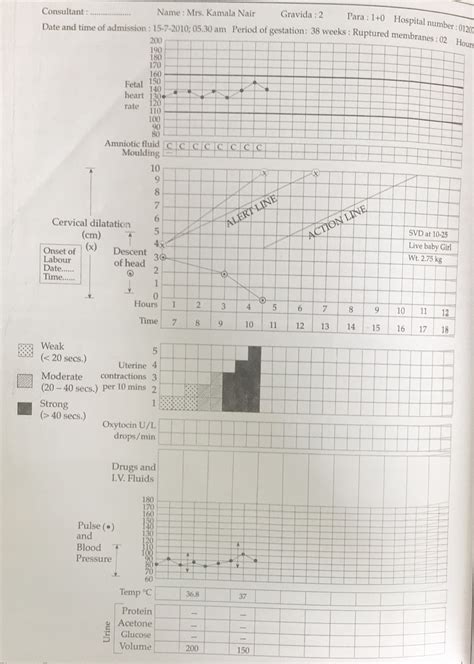 Partograph Nursing Lecture
