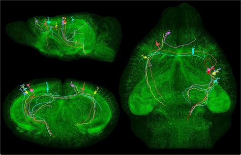 Long Distance Axonal Projections Of Individual Pyramidal Neurons Download Scientific Diagram