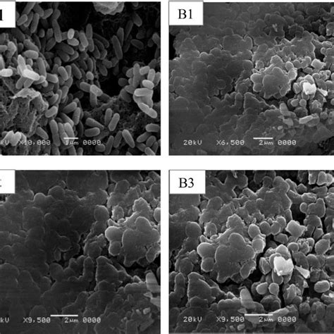 Scanning Electron Microscope Observations Of Selected Gram Negative