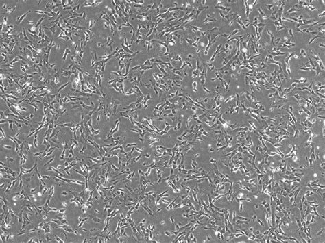 做细胞分割 Csdn社区