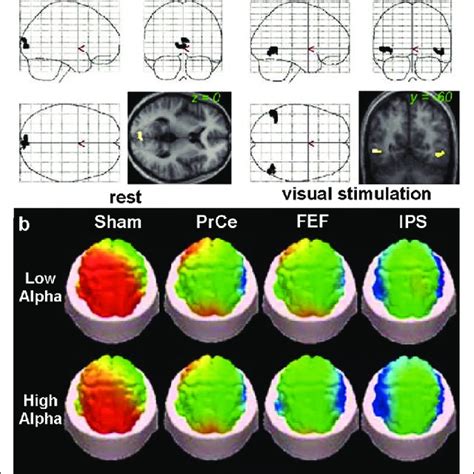 Effects Of Left And Right Posterior Parietal Cortex Ppc Transcranial Download Scientific