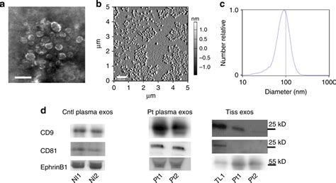 Validation Of Human Exosome Purification A Scanning Electron