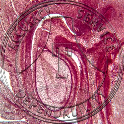 Ricinus Communis Flower Bud Non Median Ls Prepared Microscope Slide