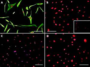 Characterisation Of Myofibroblasts In Fibrovascular Tissues Of Primary