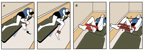 Obturator Internus Contracture An Underappreciated Cause Of Pelvic