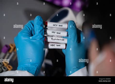 Blood Tests To Detect Sexually Transmitted Diseases Or STDs Hepatitis B And C Syphilis HIV