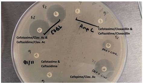 Mustafa Khandgawi On Linkedin Extended Spectrum Beta Lactamases Esbls Are Enzymes Produced By