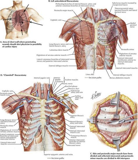 Clamshell Thoracotomy
