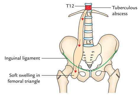 Psoas Major Earths Lab