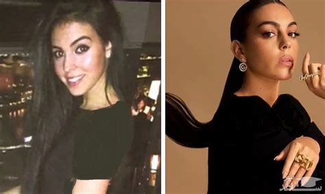 تصاویر باورنکردنی از چهره جورجینا قبل از عمل زیبایی