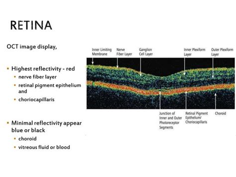 Optical Coherence Tomography OCT Macula PPTX Eye And Vision Conditions Diseases And