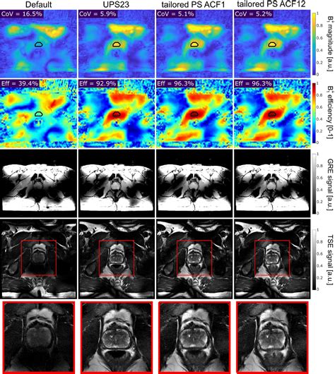 New Paper Accelerated B1 Mapping And Robust Parallel Transmit Pulse