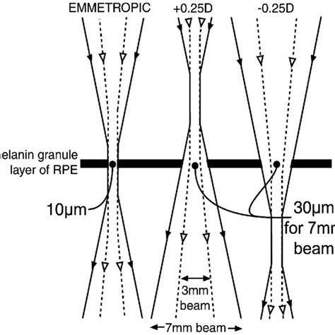 Schematic Effect Of Error In Focus For Only D Error Actual Focal Download Scientific