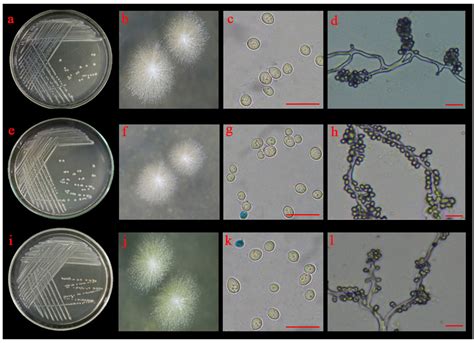 Isolation And Identification Of Fungi With Glucoamylase Activity From Loog Pang Khao Mak A Thai