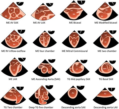 Transesophageal Echocardiogram Views