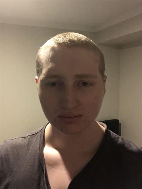 I Love Smegma Rsmegmalovers