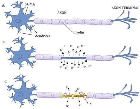 Demyelination Of Nerve Docmuscles
