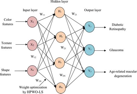 optimal dnn for fundus image classification download scientific diagram