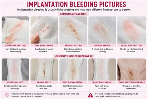 Implantation Bleeding Pictures Here Is What It Looks Like