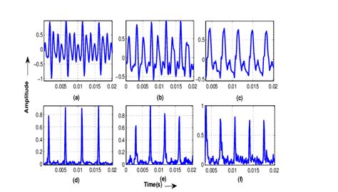 Illustration Of Difference In Nature Of Excitation Source In Vowels