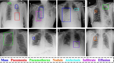 Figure 1 From Multi Level Residual Feature Fusion Network For Thoracic Disease Classification In