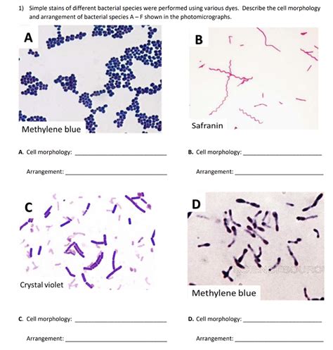 Solved 1 Simple Stains Of Different Bacterial Species Were Performed 1 Answer
