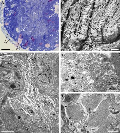 The Muscular Bundle And The Leaflet Nerve Light And Electron Download Scientific Diagram