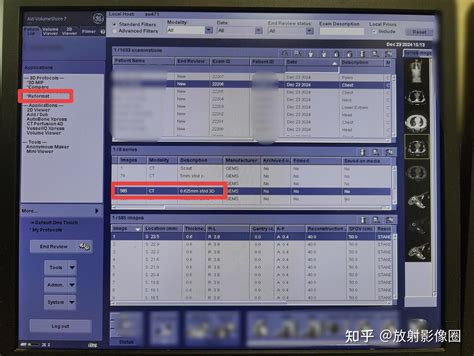 浅谈ct三维重建的操作方法 知乎