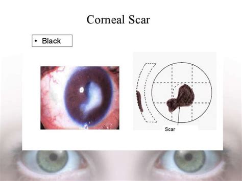 Eye Colour Coding
