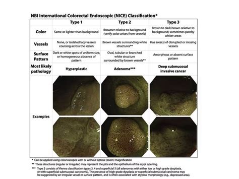 Emr Endoscopic Mucosal Resection Pptx Digestive Disorders