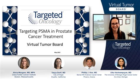 Case 2 Metastatic Hormone Sensitive Prostate Cancer