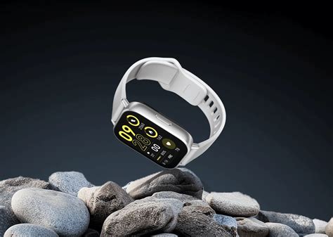 Redmi Watch 5 Active Mi Homero