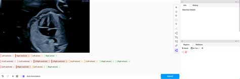 Prediction Doesn T Show Up In The Ui Issue Humansignal Label Studio Ml Backend Github