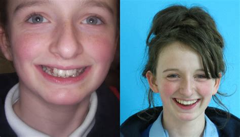 Emma Forde Orthodontic Society Of Ireland