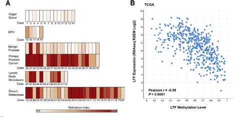 Figure 1 From Tumorigenesis And Neoplastic Progression Lactoferrin Cpg Island Hypermethylation