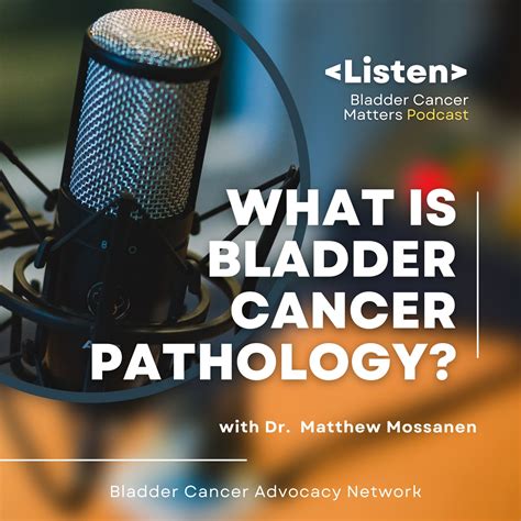 What To Know About Bladder Cancer Bcg Treatments