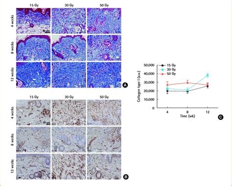 Fibrosis Analysis And Collagen Quantification Fibrosis And Collagen Download Scientific Diagram