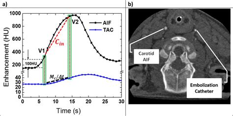 two volume ct perfusion measurement protocol a top curve arterial