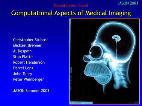 PPT Computational Aspects Of Medical Imaging PowerPoint Presentation ID