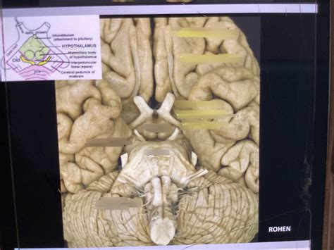 Neuro Practical Diagram Quizlet