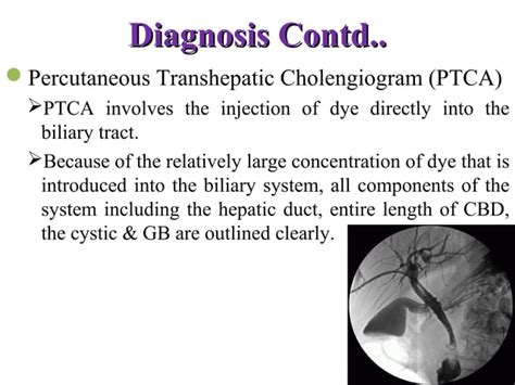 Cholecystitis And Cholelithiasis Ppt