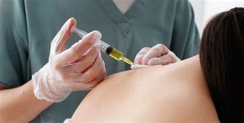 Trigger Point Injections Live Alive