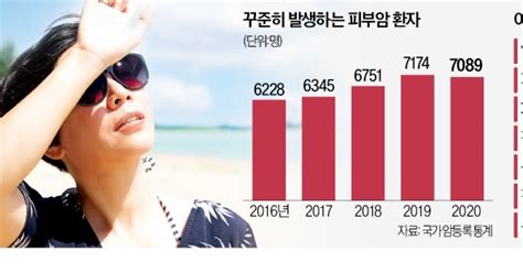 일광욕 후 점점 커지는 점·손발톱에 검은색 선혹시 피부암일까