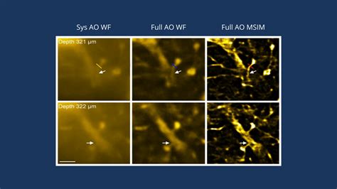 Adaptive Optics Enables Deep Imaging In 2 Photon Super Resolution Structured Illumination